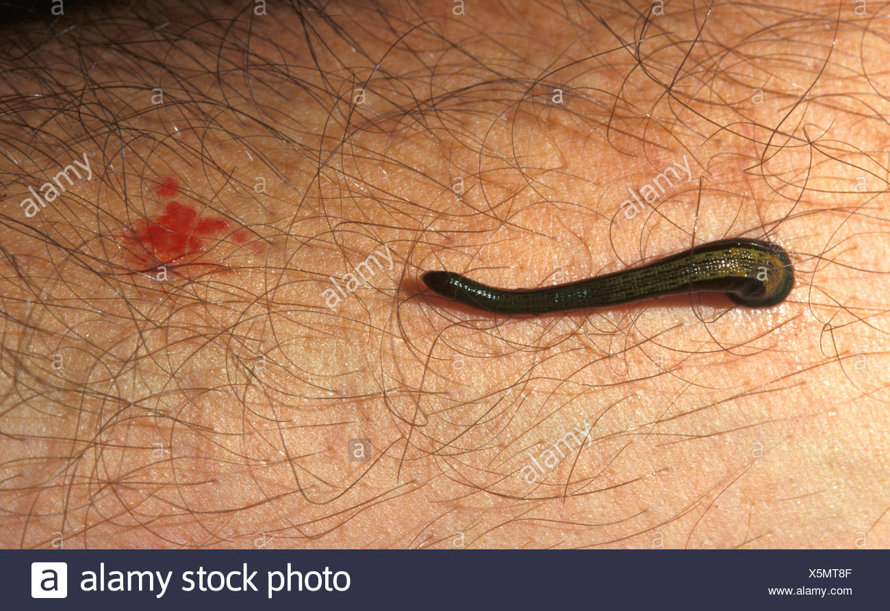 Leech Blood Stock Photos & Leech Blood Stock Images - Alamy