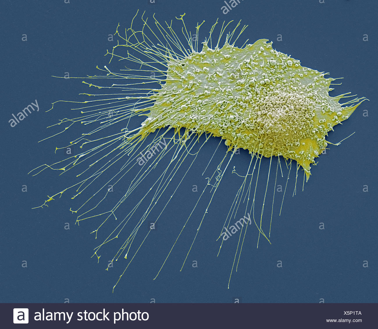 Scanning Electron Micrograph, Bone High Resolution Stock Photography ...
