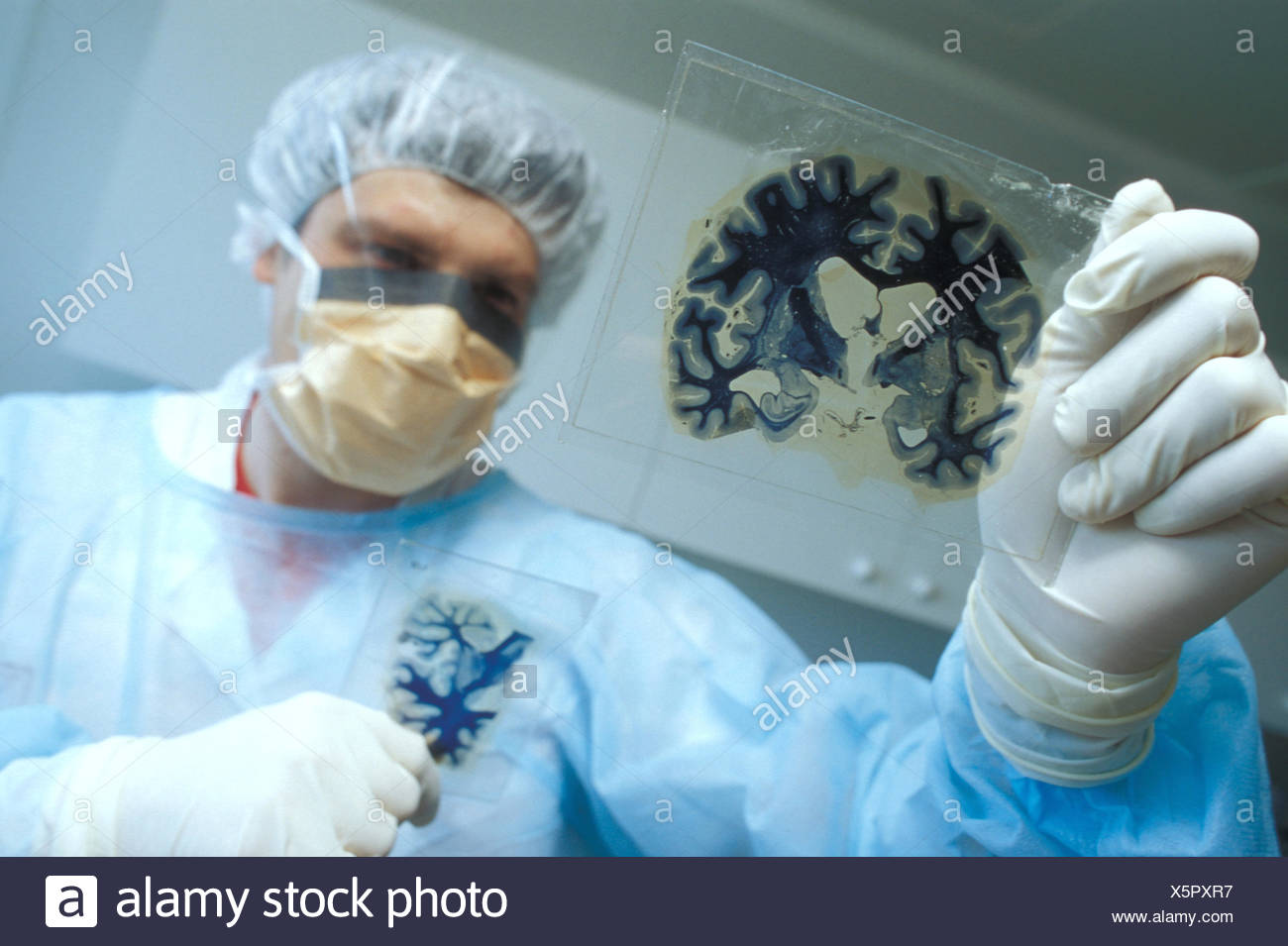 Prion Disease High Resolution Stock Photography and Images - Alamy