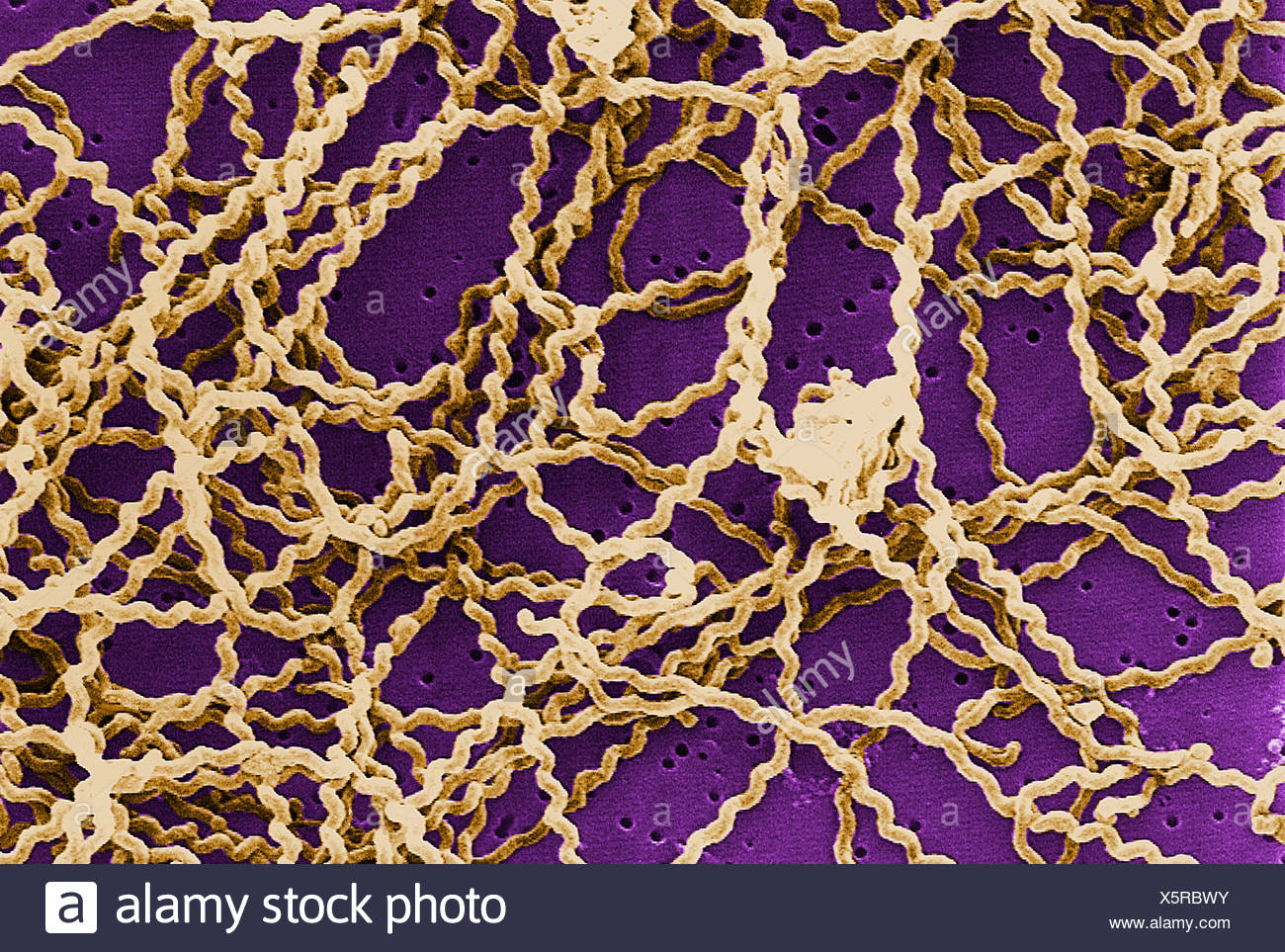 Bacteria Cell Electron Micrograph High Resolution Stock Photography and ...