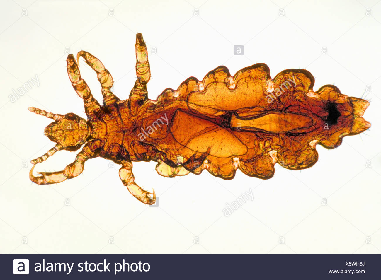 Pediculus Humanus Corporis High Resolution Stock Photography and Images ...