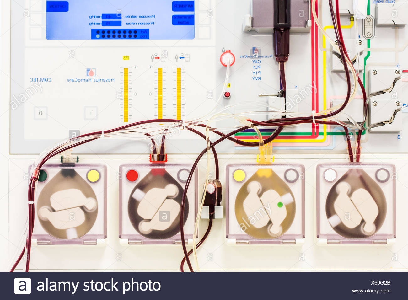 Apheresis High Resolution Stock Photography and Images - Alamy
