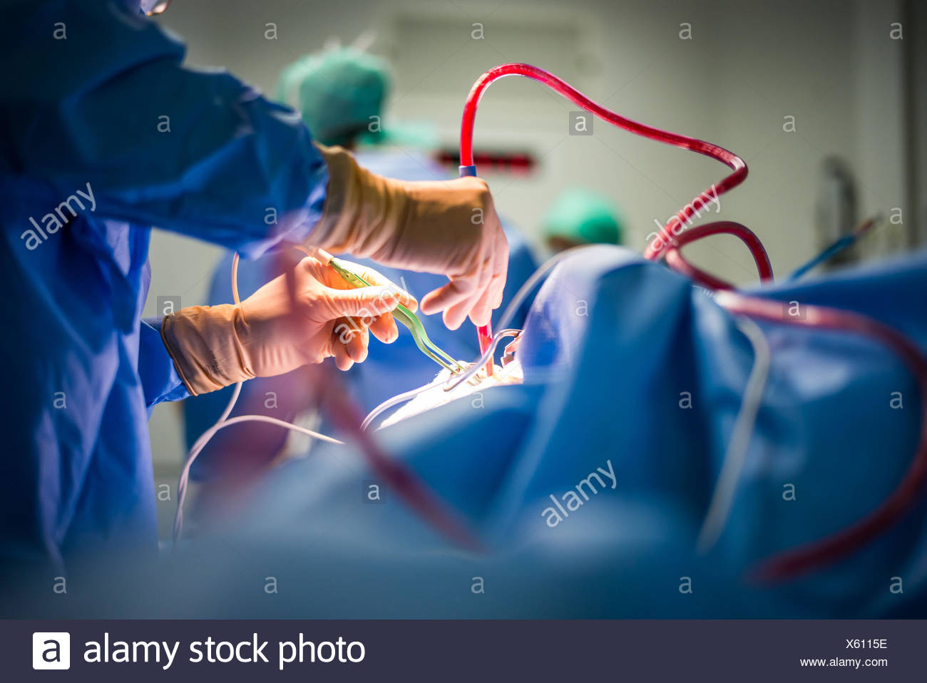 Tonsil Surgery High Resolution Stock Photography and Images - Alamy