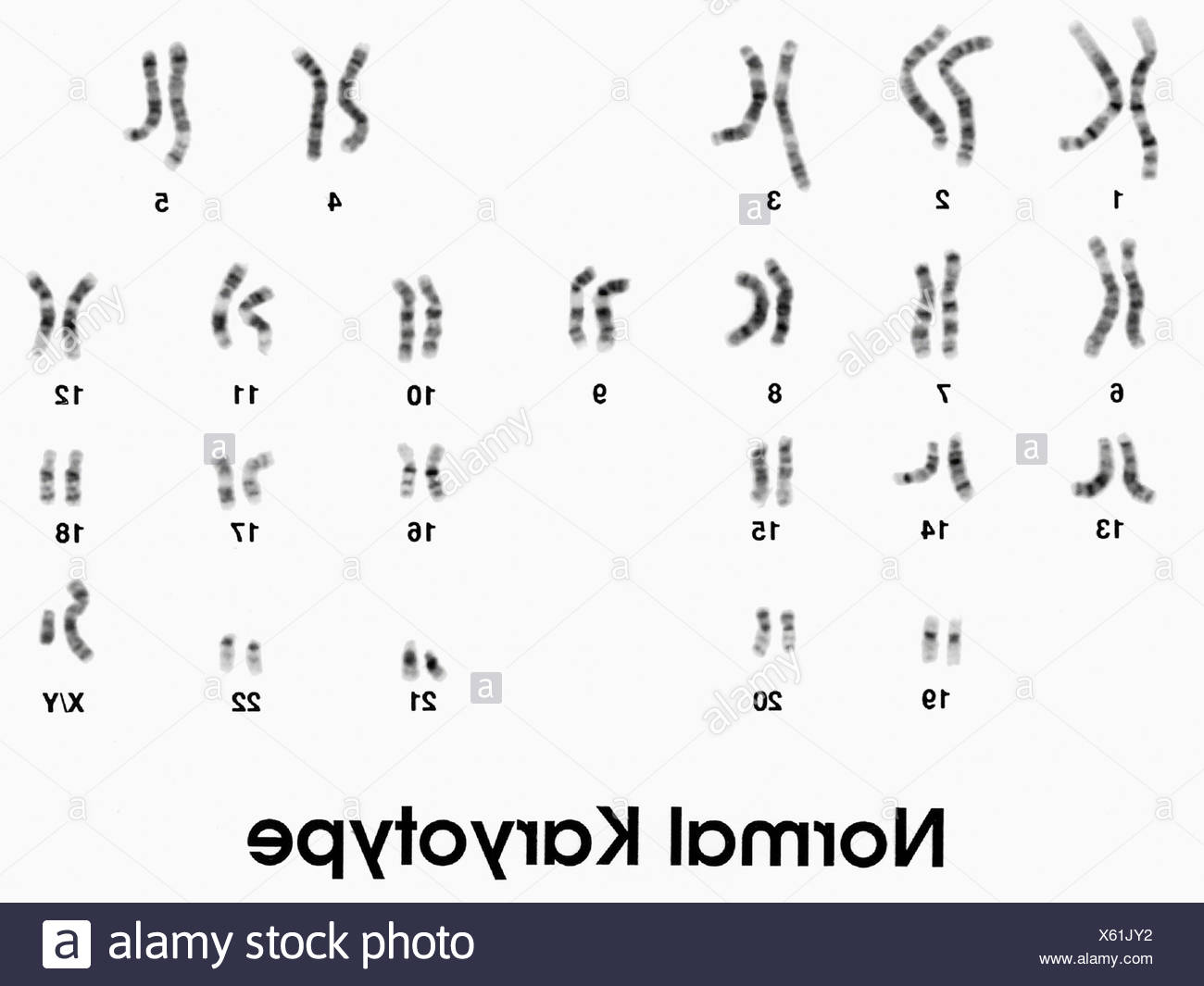 Karyotype High Resolution Stock Photography and Images - Alamy