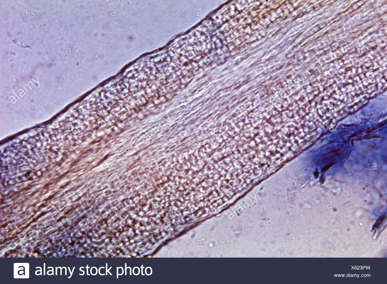 Dermatophyte Stock Photos & Dermatophyte Stock Images - Alamy