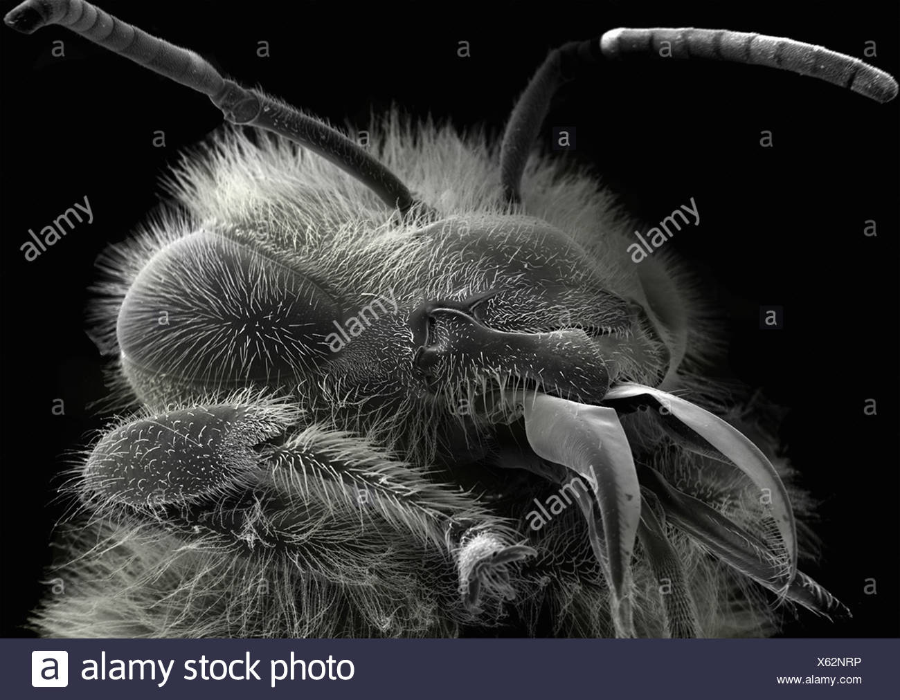 Hair Microscope Sem High Resolution Stock Photography and Images - Alamy