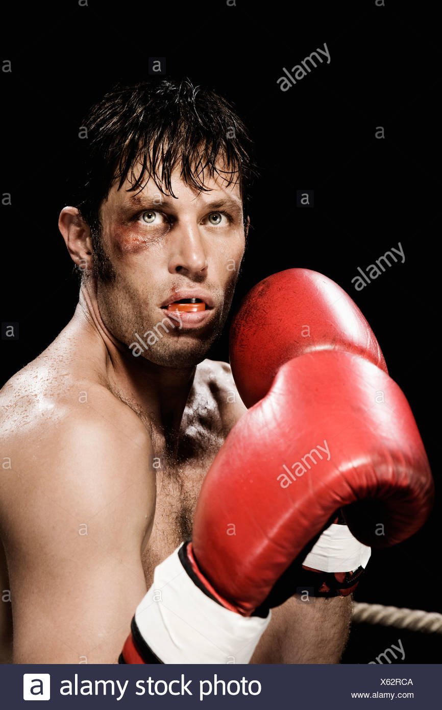 Chest Bruise High Resolution Stock Photography and Images - Alamy