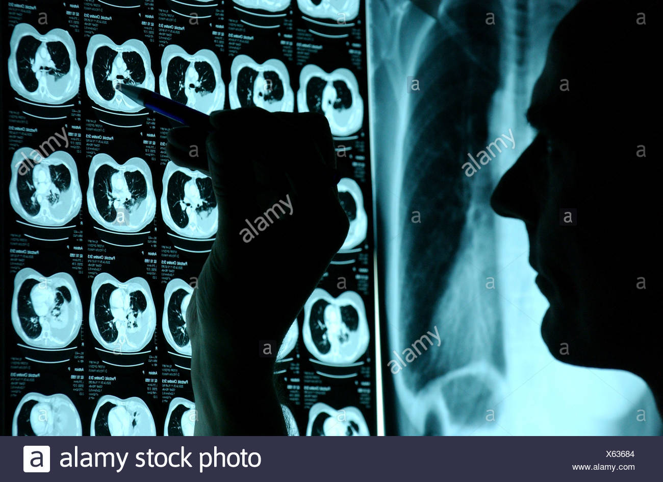 Roentgen High Resolution Stock Photography and Images - Alamy