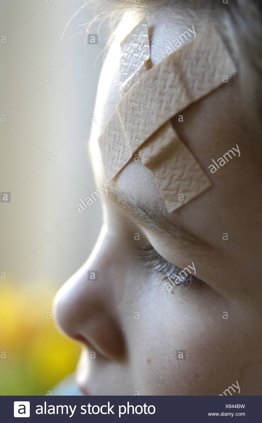 Forehead Injury High Resolution Stock Photography and Images - Alamy