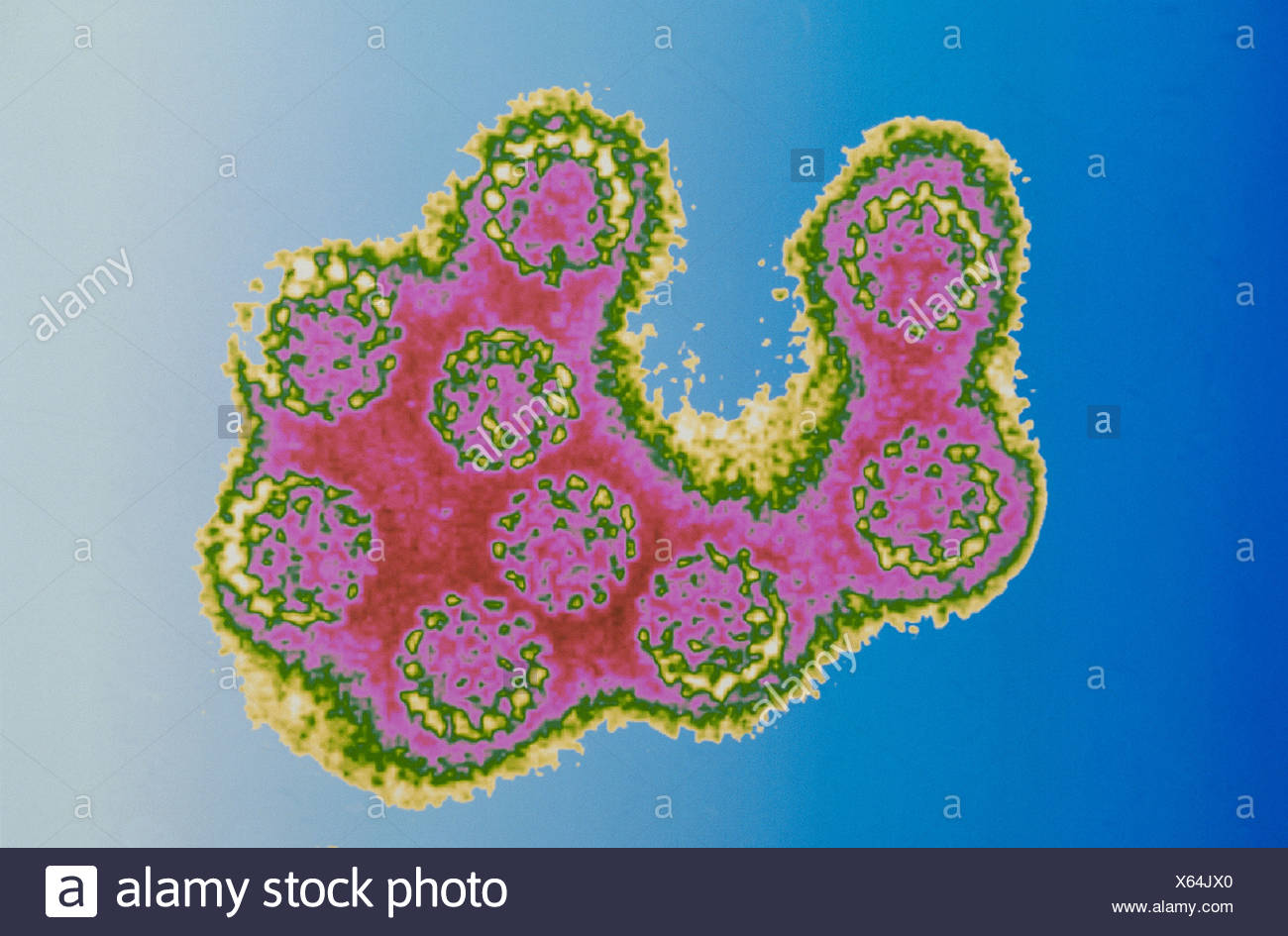 Human Papilloma Virus High Resolution Stock Photography and Images - Alamy