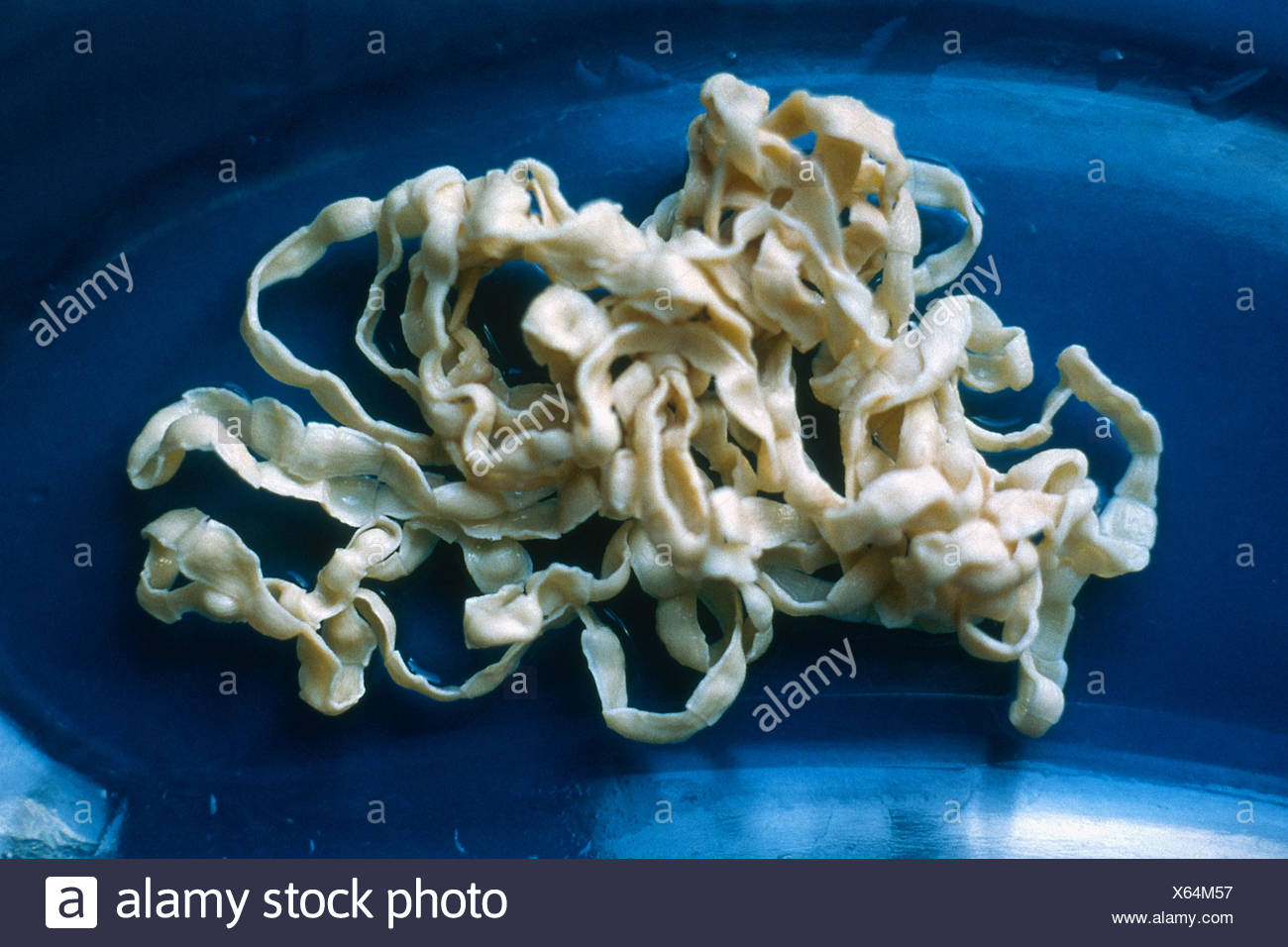 Taenia Saginata Stock Photos & Taenia Saginata Stock Images - Alamy