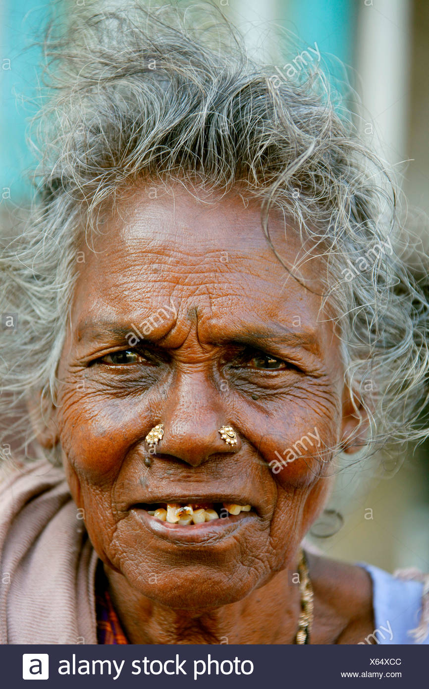 Bad Teeth Woman High Resolution Stock Photography and Images - Alamy