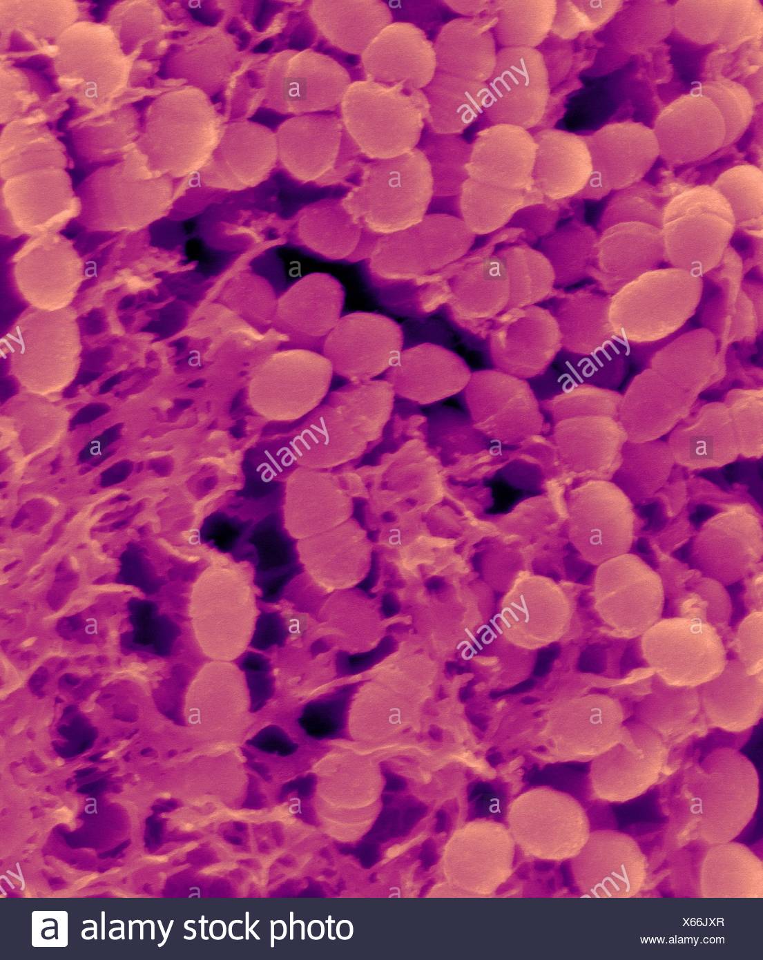 Biofilm Dental High Resolution Stock Photography and Images - Alamy