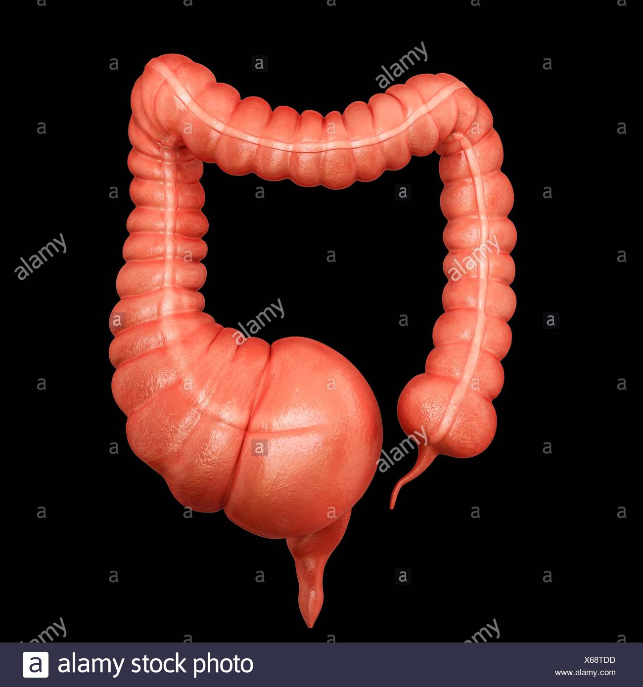 Megacolon High Resolution Stock Photography and Images - Alamy