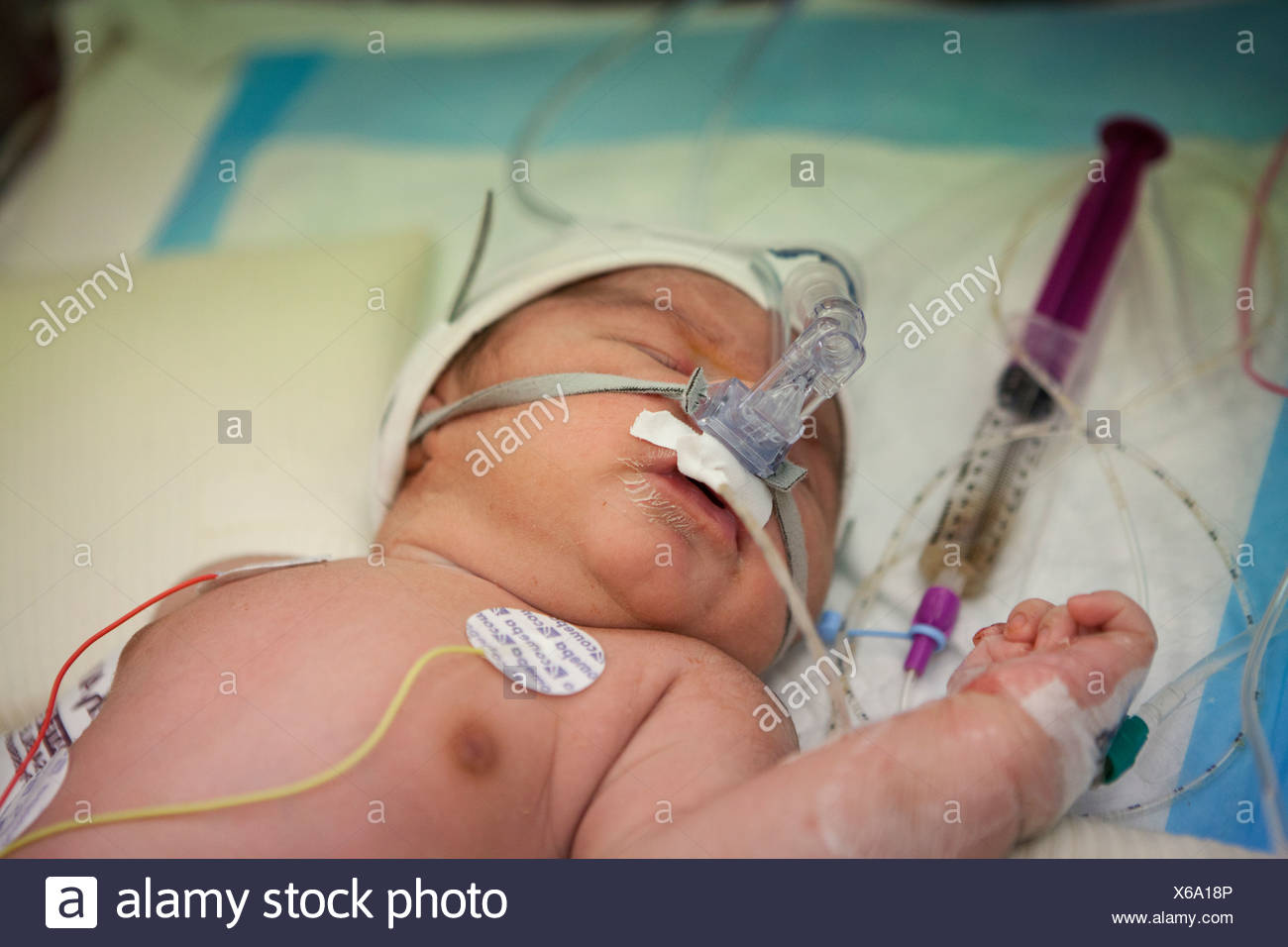 Pediatric Icu High Resolution Stock Photography and Images - Alamy