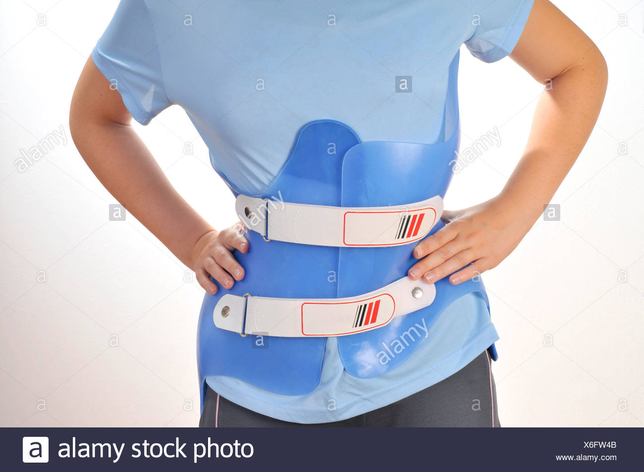 Girl Wearing Chenau Scolioses Corset High Resolution Stock Photography ...