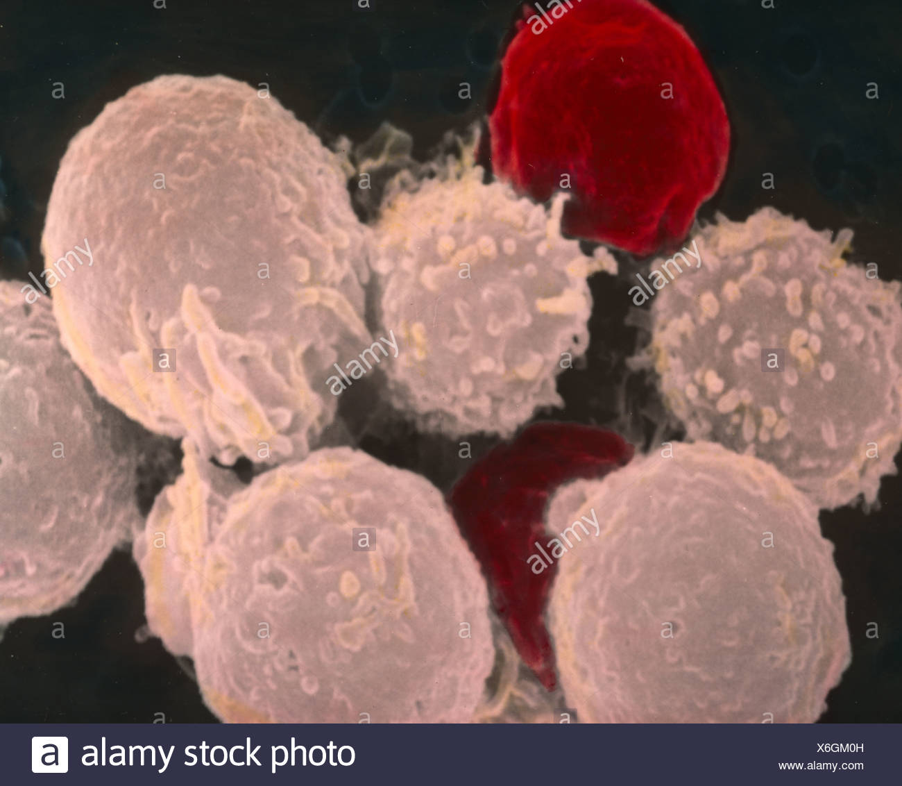 Scanning Electron Microscopy Stock Photos & Scanning Electron ...