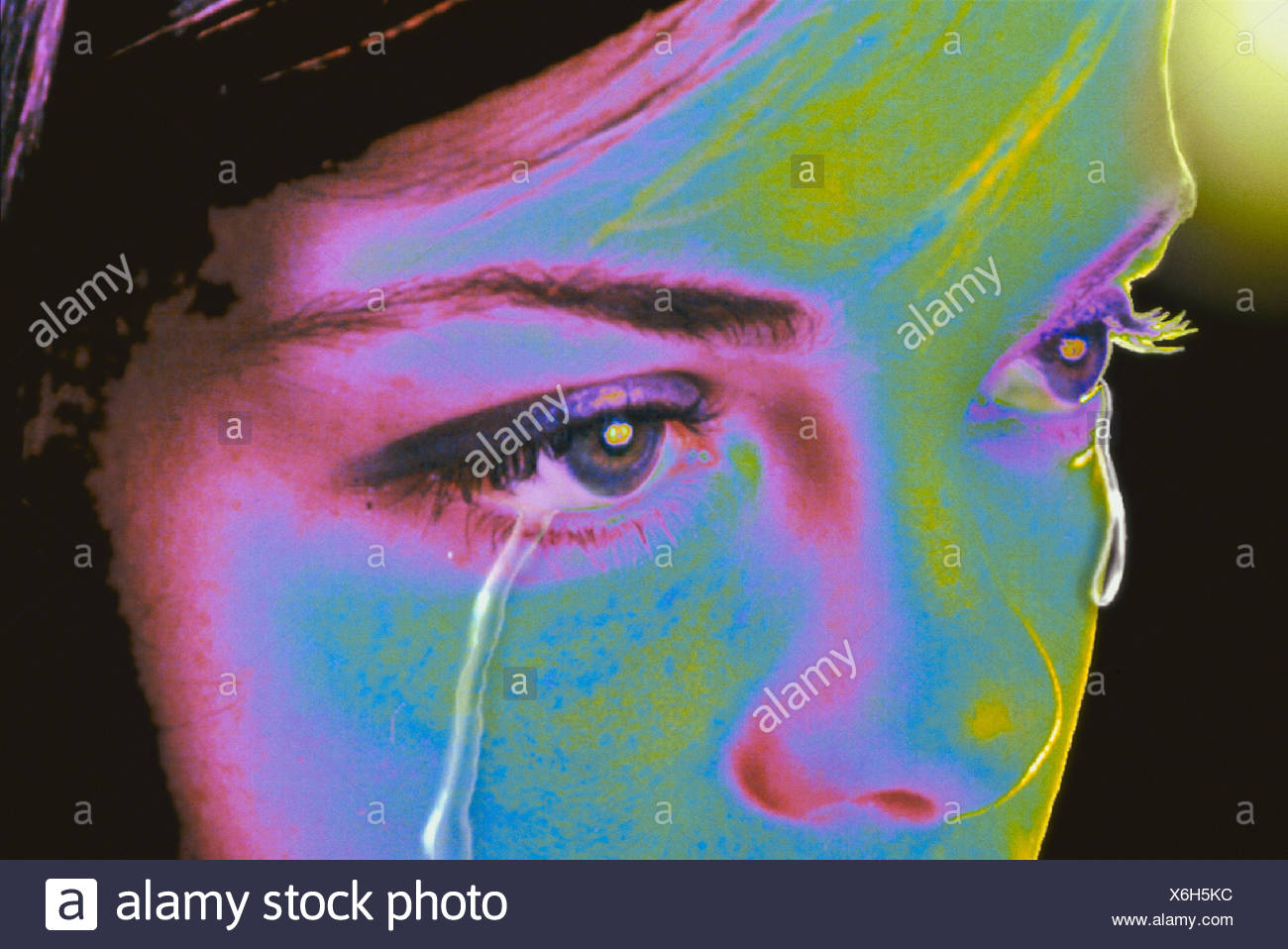 Lacrimal Glands High Resolution Stock Photography and Images - Alamy