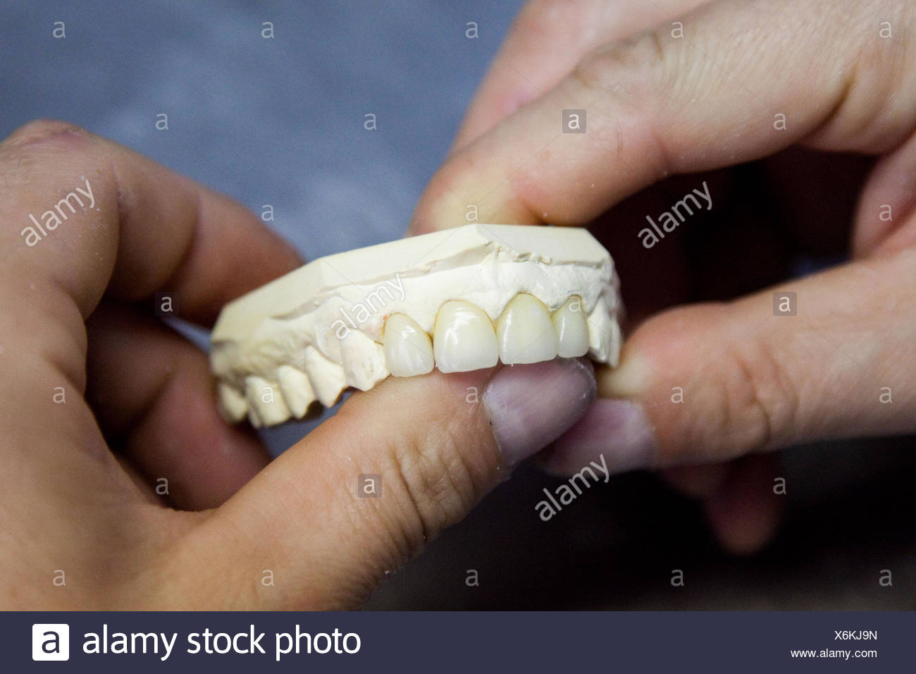 Artificial Dental Crowns High Resolution Stock Photography and Images ...