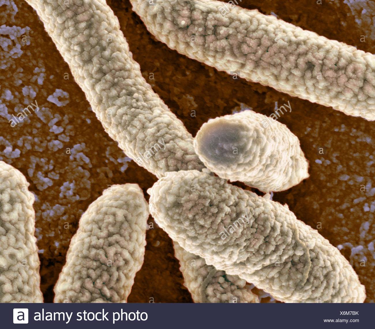 Escherichia Coli Microscope High Resolution Stock Photography and ...