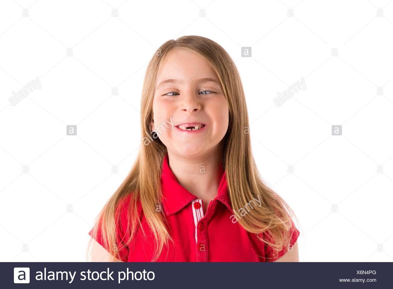Child Girl With Crossed Eyes High Resolution Stock Photography and ...