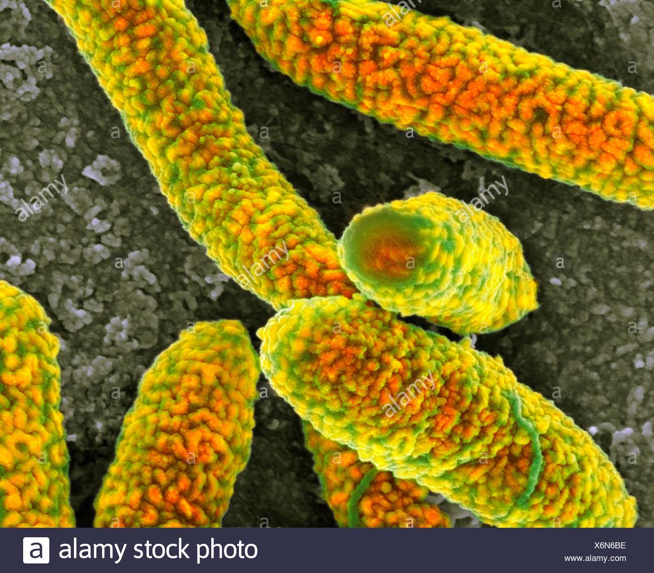 Escherichia Coli Microscope High Resolution Stock Photography and ...