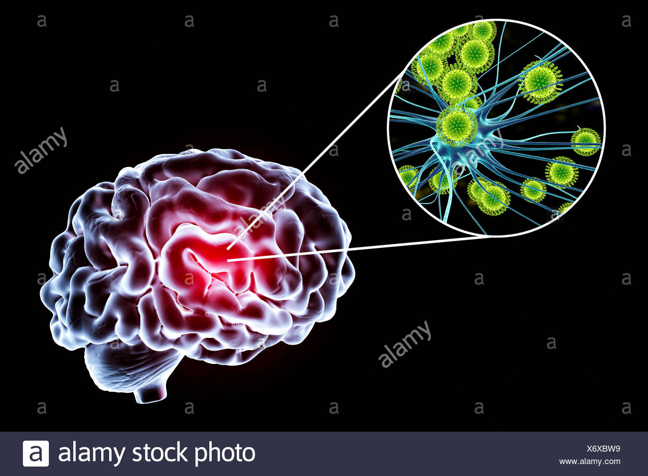 Eastern Equine Encephalitis Virus High Resolution Stock Photography and ...