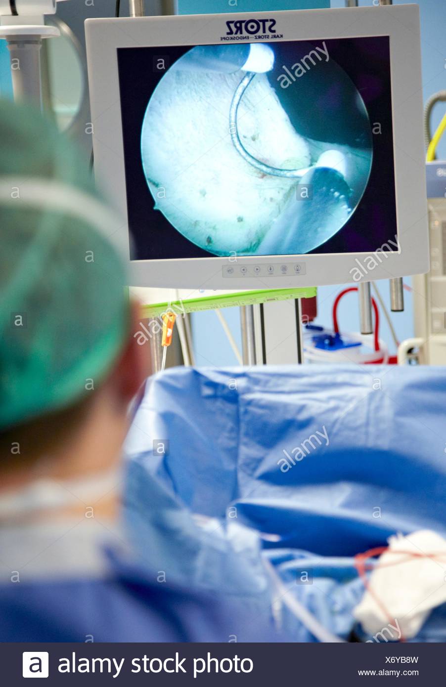 Transurethral Resection High Resolution Stock Photography and Images ...