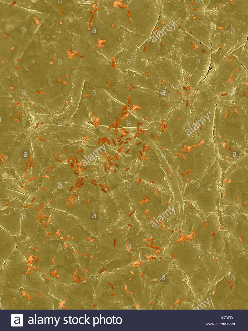 Enteric Bacterial Pathogen High Resolution Stock Photography and Images ...