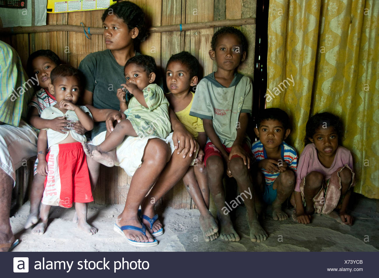 Malnutrition Boys Stock Photos & Malnutrition Boys Stock Images - Alamy