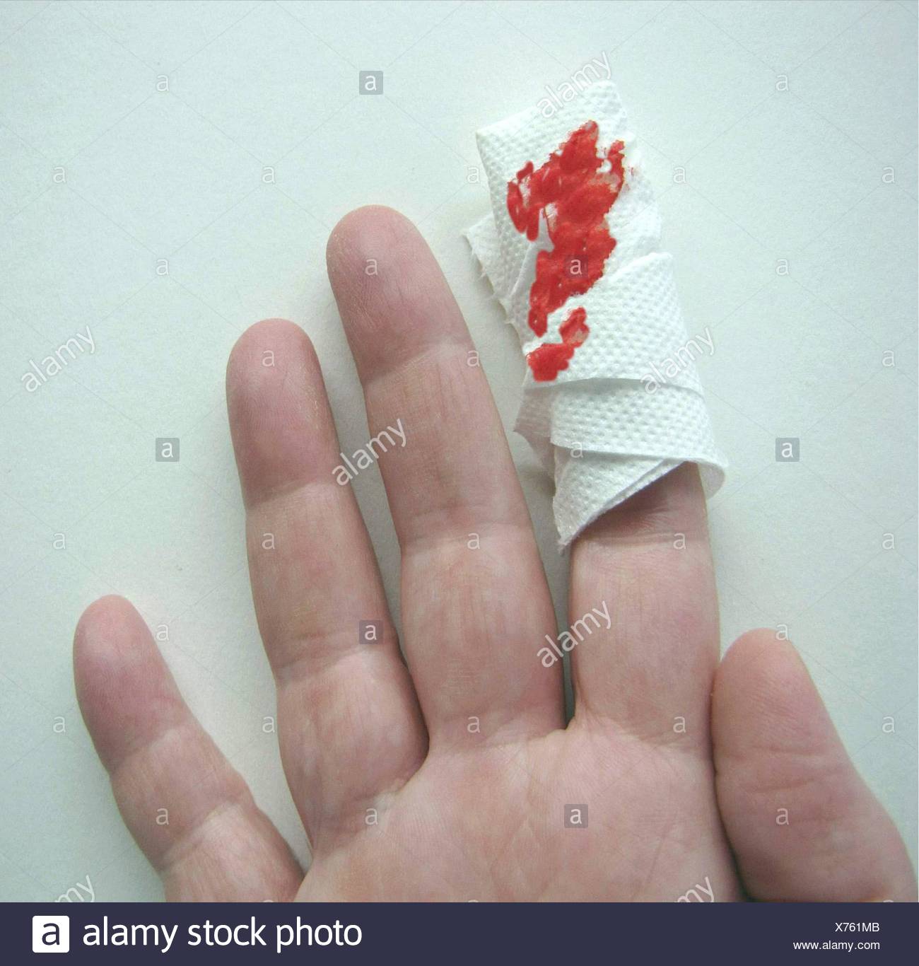 Bloody Accident High Resolution Stock Photography and Images - Alamy