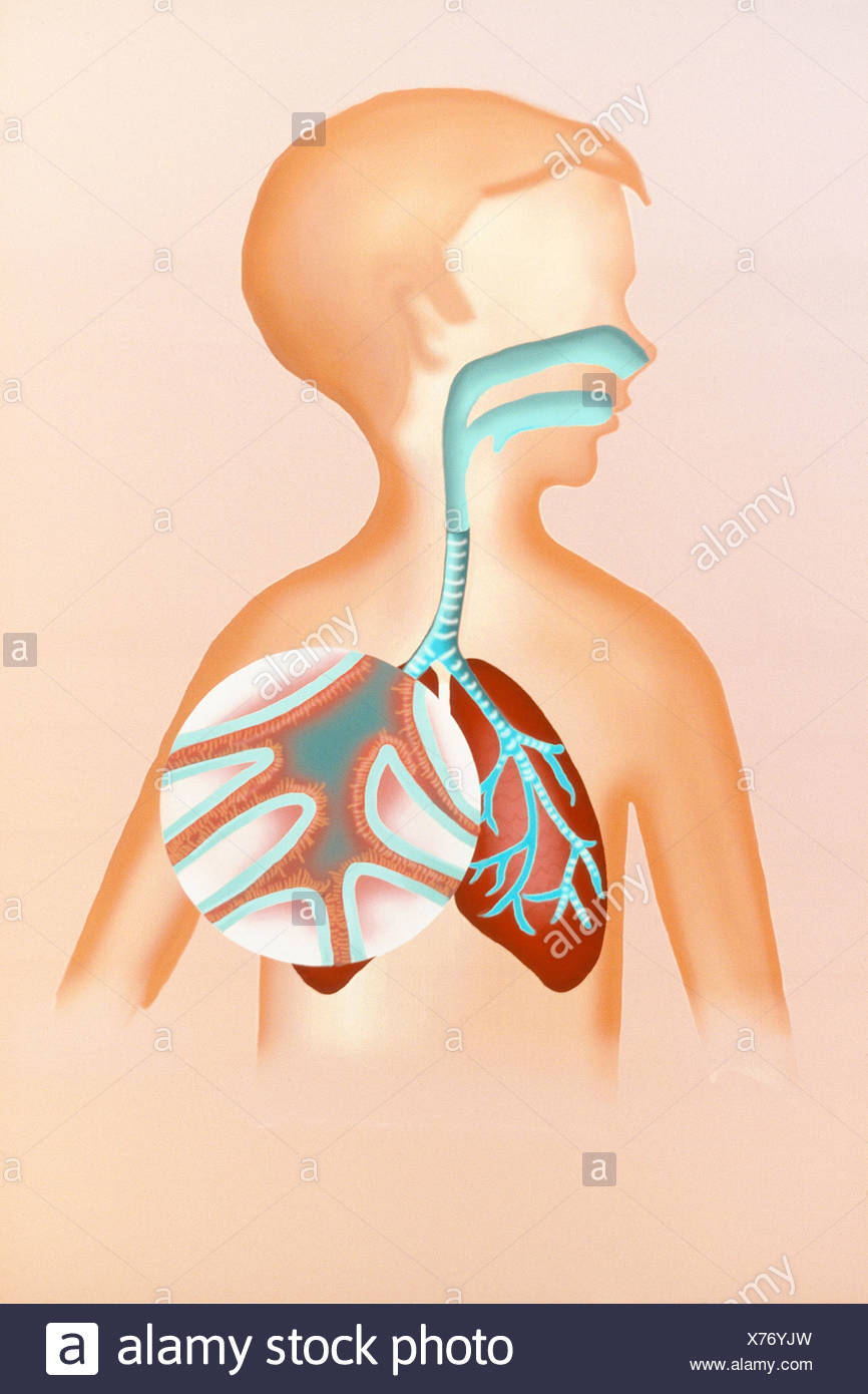 Bronchiolitis High Resolution Stock Photography and Images - Alamy