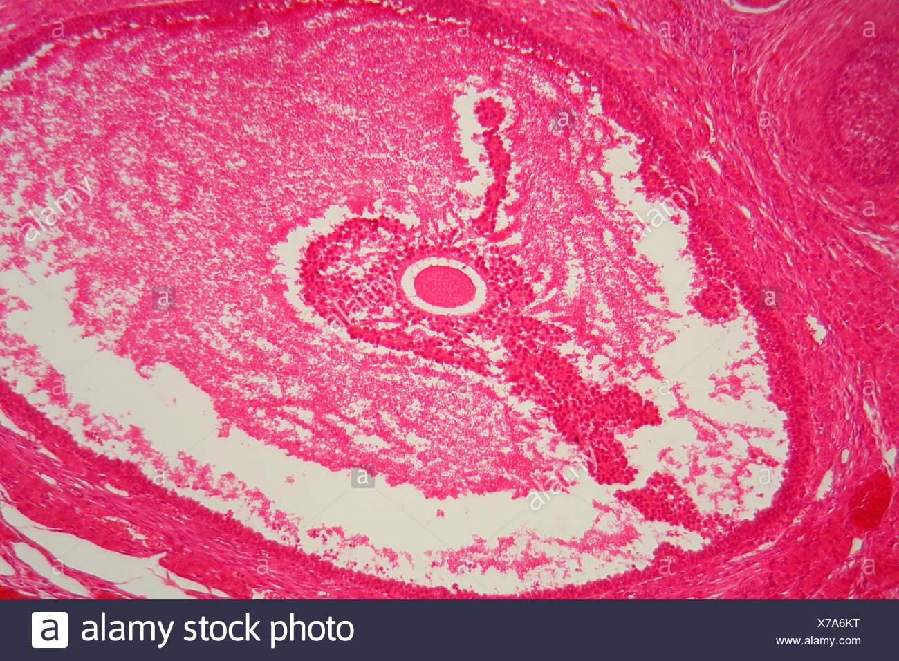Human Ovary Microscope High Resolution Stock Photography and Images - Alamy