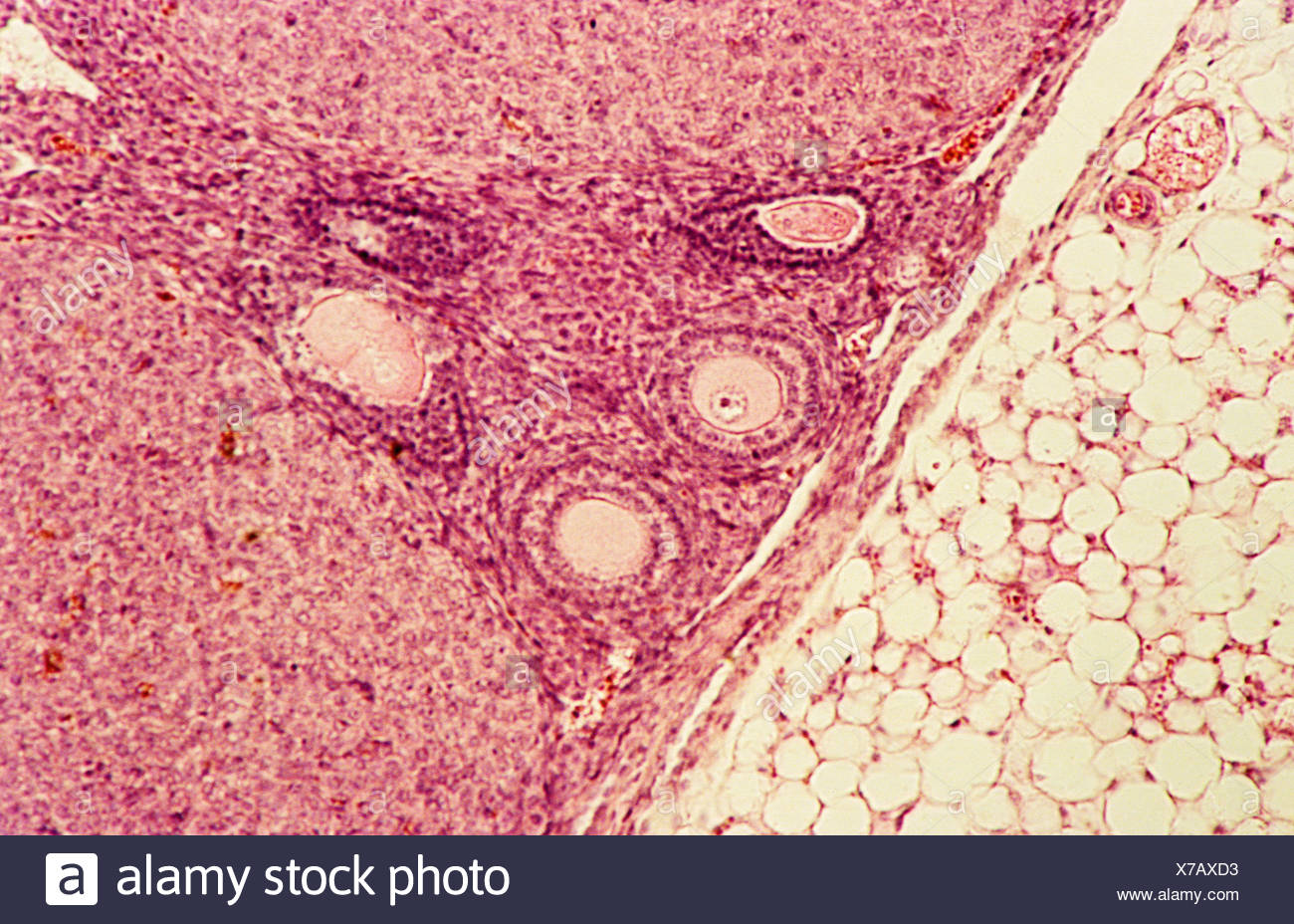 Histology Ovary Stock Photos & Histology Ovary Stock Images - Alamy