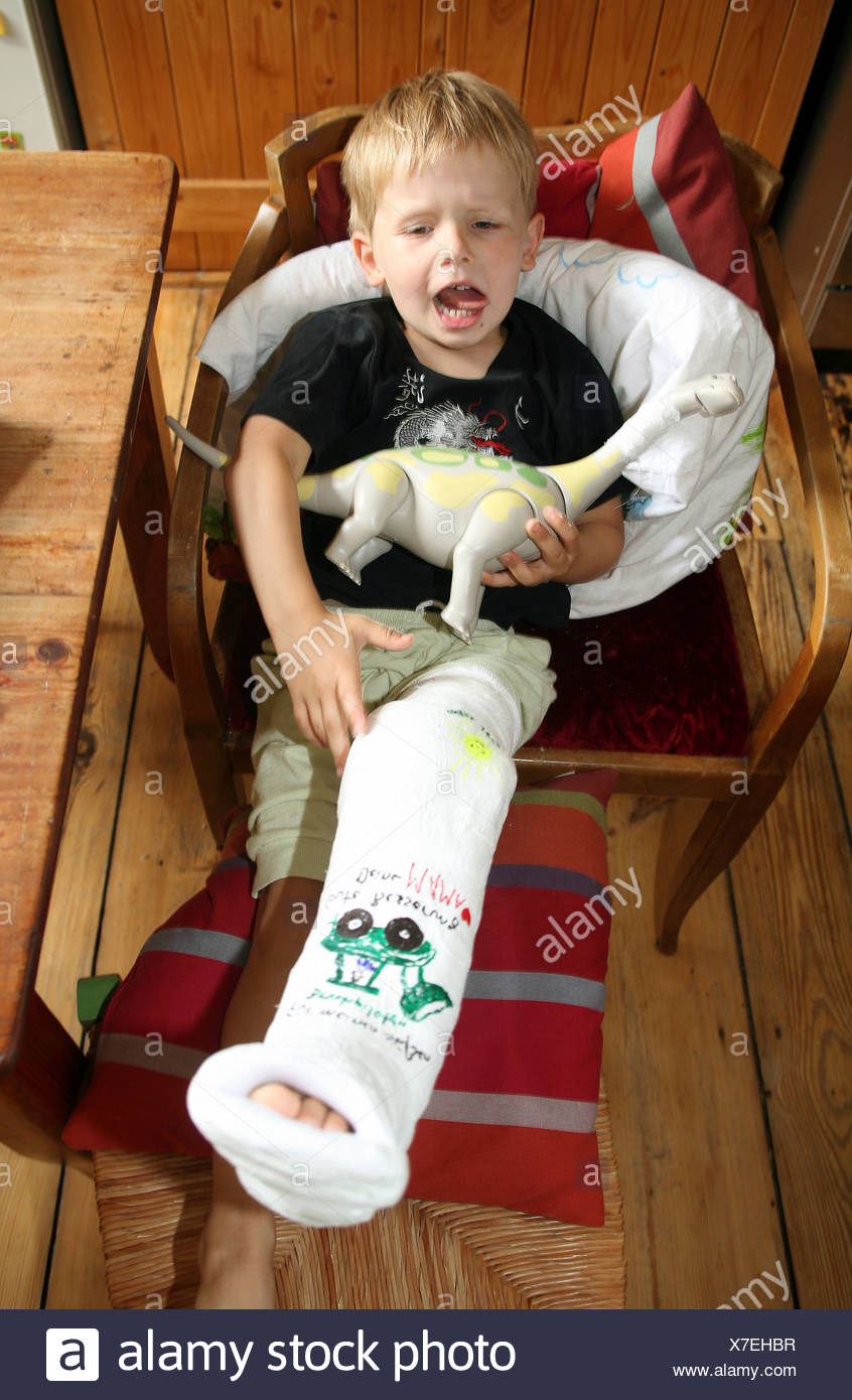 Boy Child With Broken Leg High Resolution Stock Photography and Images ...