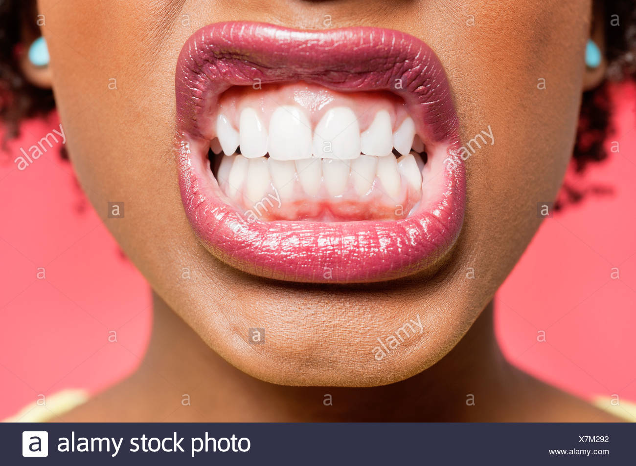 Clenching Teeth Adult Stock Photos & Clenching Teeth Adult Stock Images ...