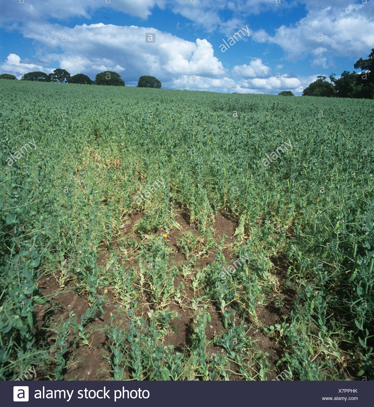 Foot Infection High Resolution Stock Photography and Images - Alamy