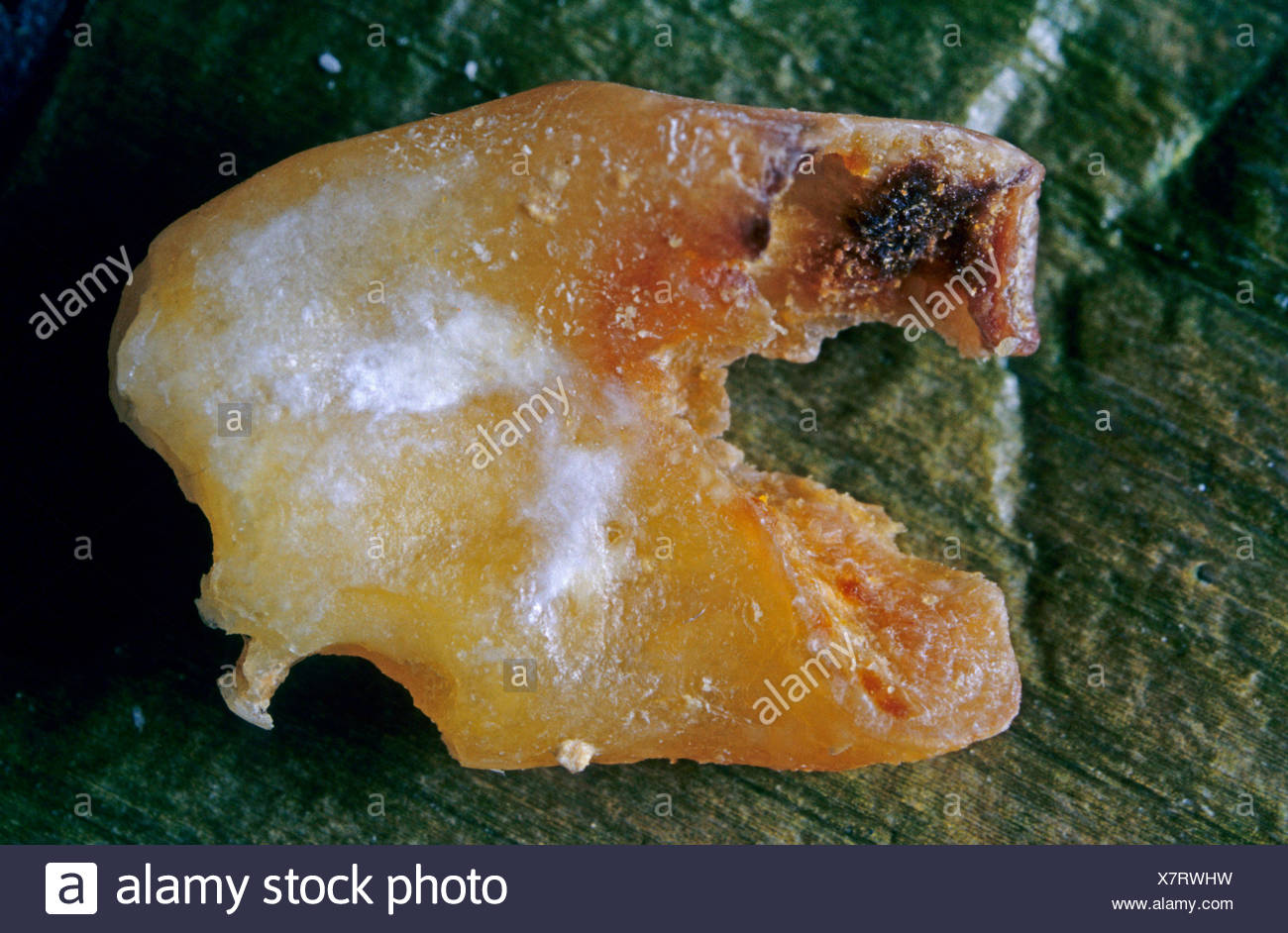 Rotten Teeth High Resolution Stock Photography and Images - Alamy