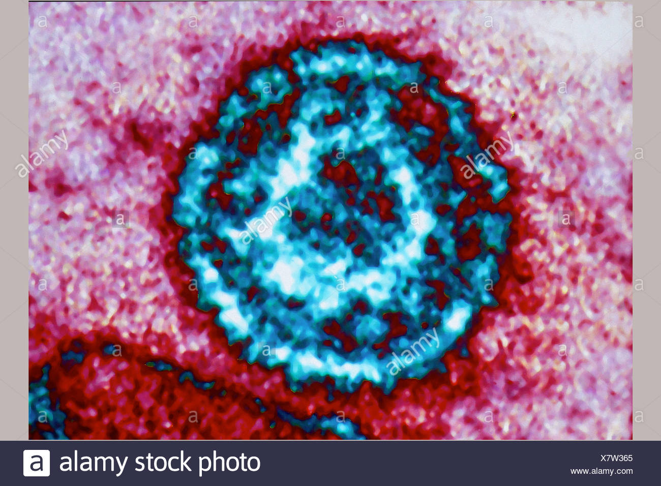 Epstein Barr Virus High Resolution Stock Photography and Images - Alamy