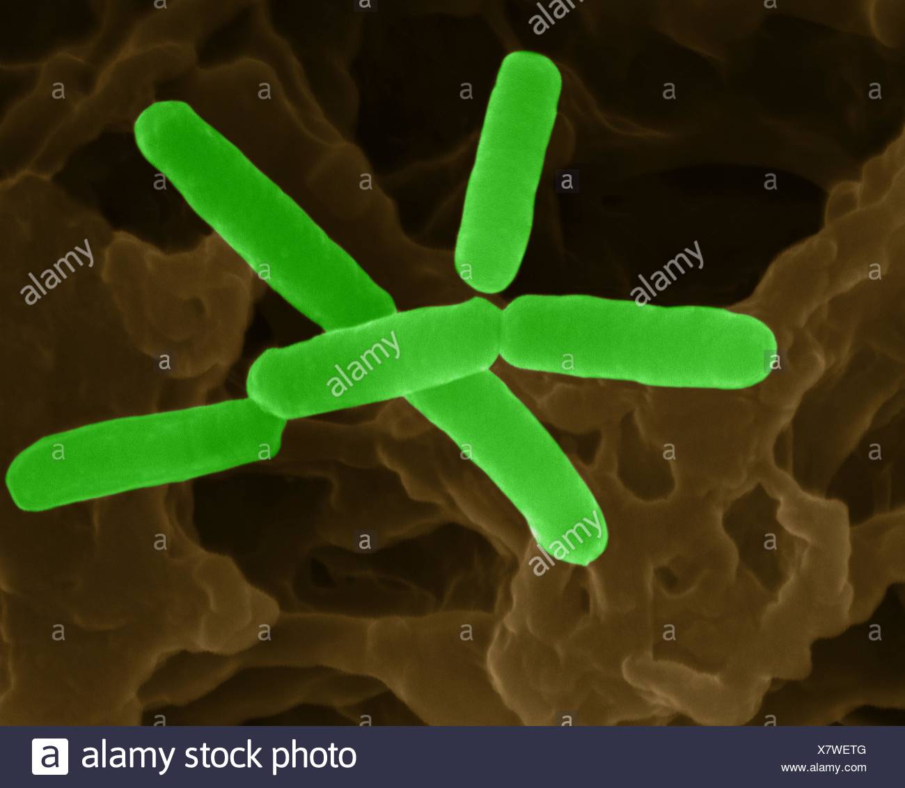 Symbiotic Root Nodules High Resolution Stock Photography and Images - Alamy