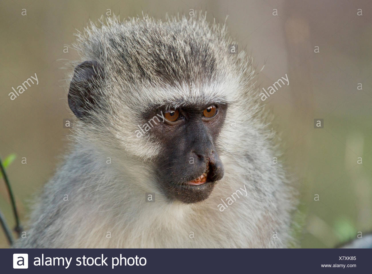 Cleft Palate High Resolution Stock Photography and Images - Alamy