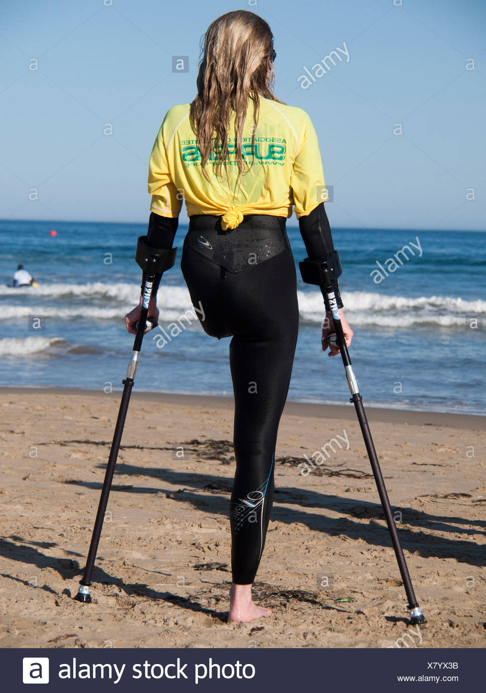 Woman Lost Leg Stock Photos & Woman Lost Leg Stock Images - Alamy