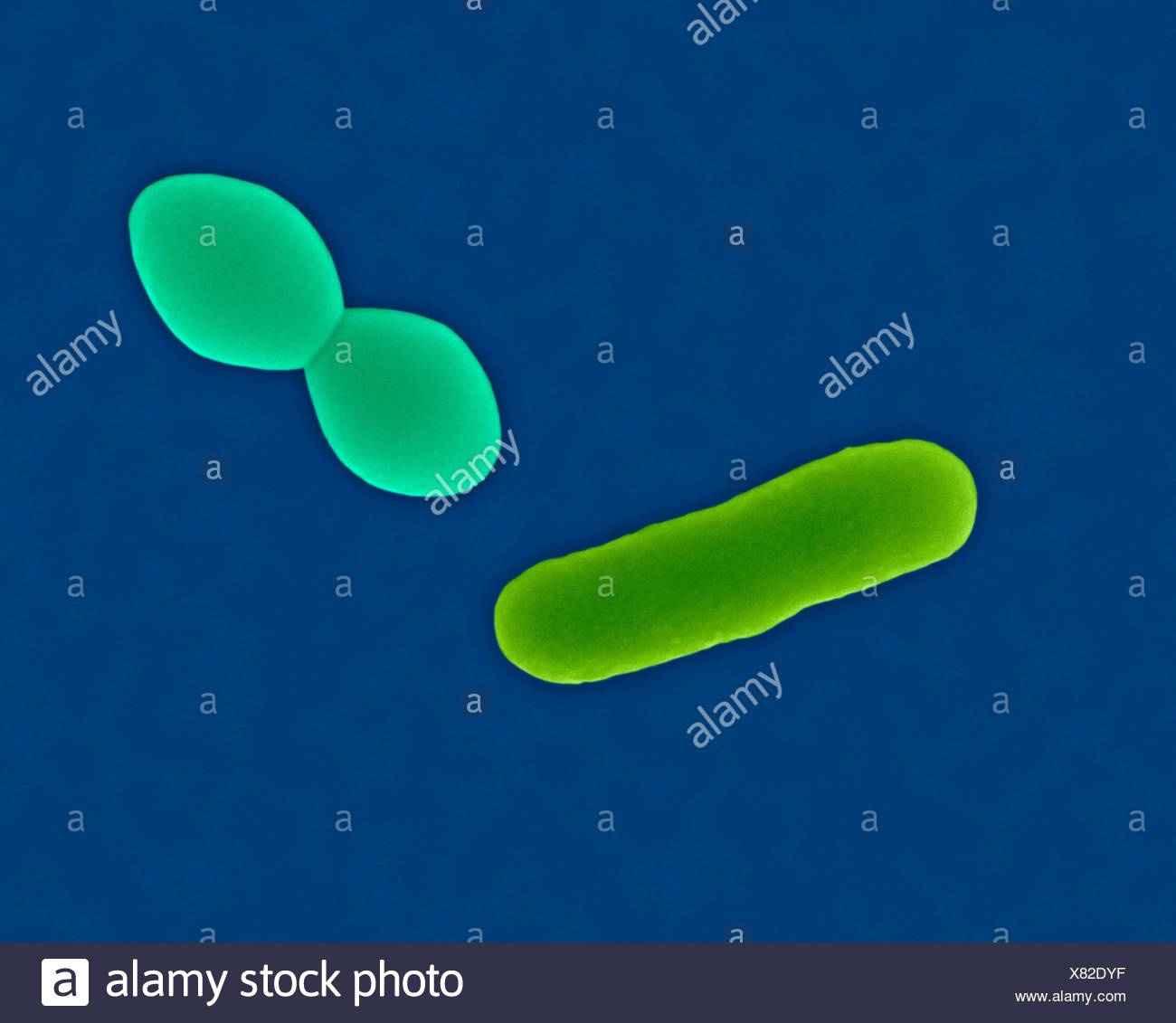 Streptococcus Pneumoniae Gram High Resolution Stock Photography and ...