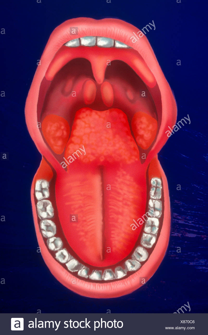 Lingual Tonsil High Resolution Stock Photography and Images - Alamy