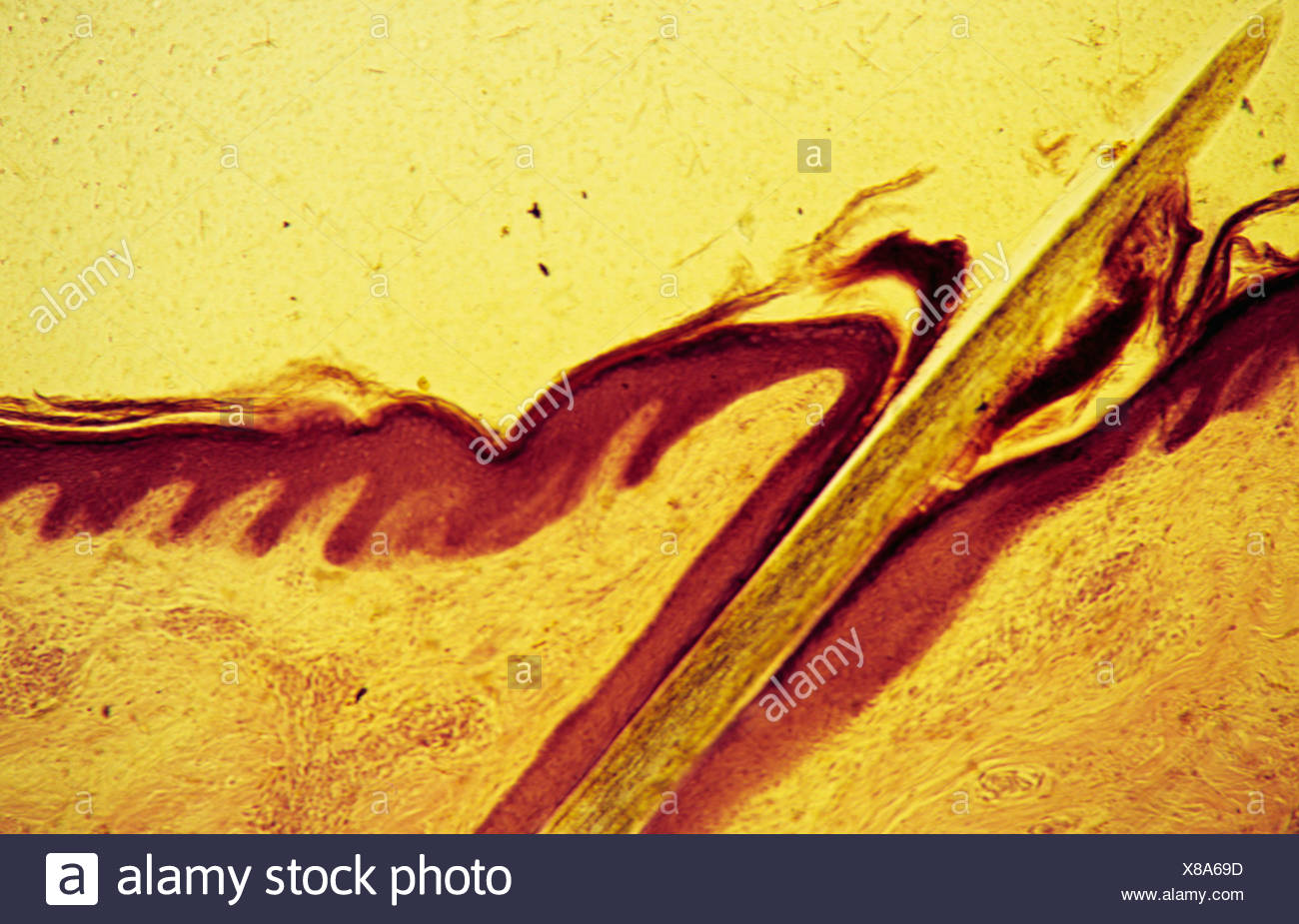 Epithelial Stock Photos & Epithelial Stock Images - Alamy