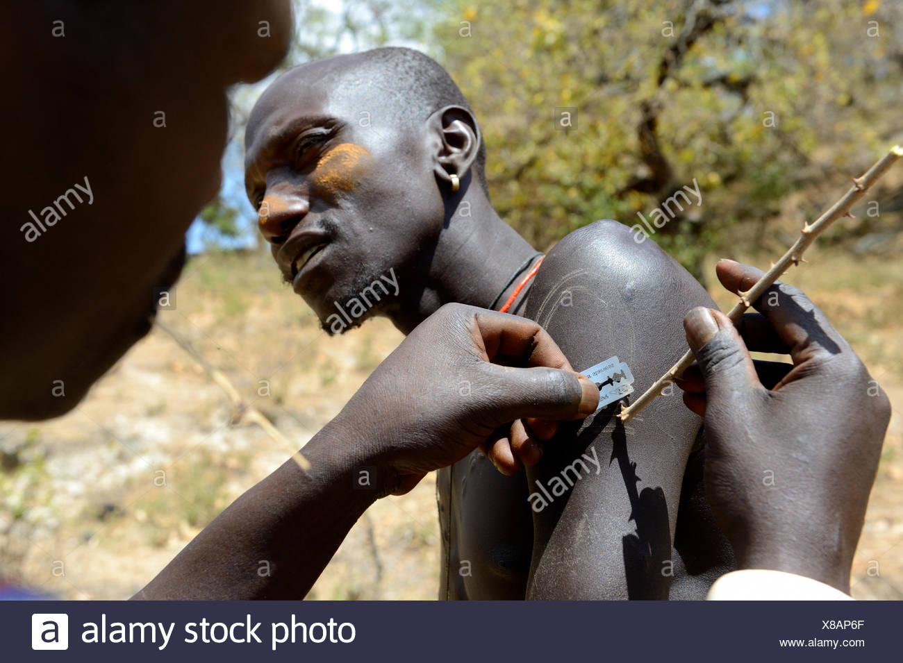 Scars Arm High Resolution Stock Photography and Images - Alamy