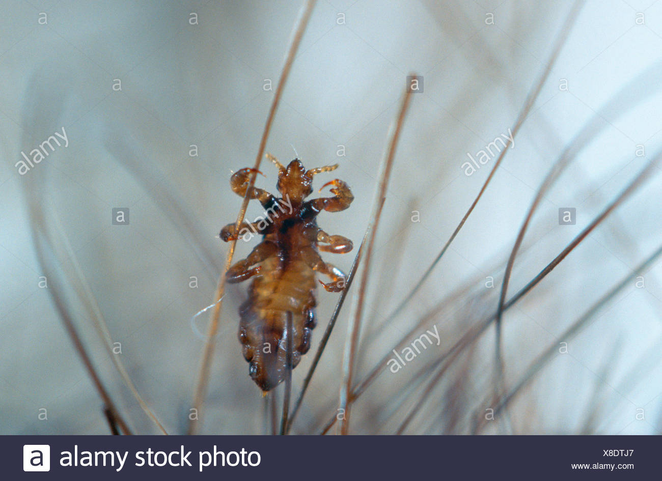 Pediculus Humanus Capitis High Resolution Stock Photography and Images ...
