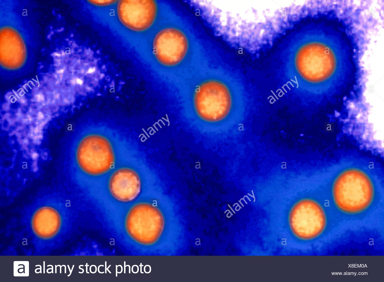 Picornavirus High Resolution Stock Photography and Images - Alamy