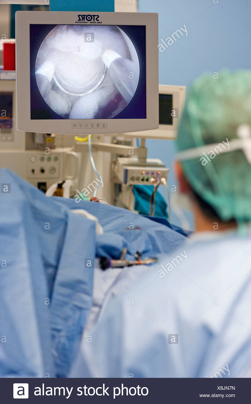 Transurethral Resection High Resolution Stock Photography and Images ...