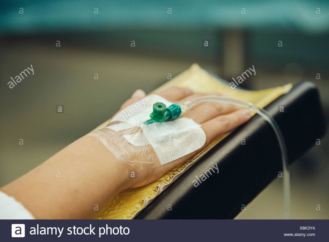 Cannula Hand Stock Photos & Cannula Hand Stock Images - Alamy